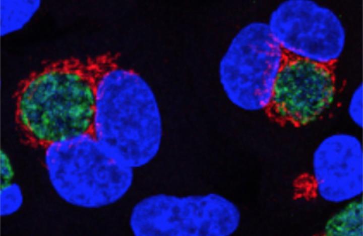 Chlamydia Infecting Human Cell [IMAGE] | EurekAlert! Science News Releases