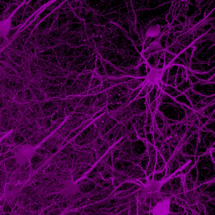 Brain wiring map [IMAGE] | EurekAlert! Science News Releases