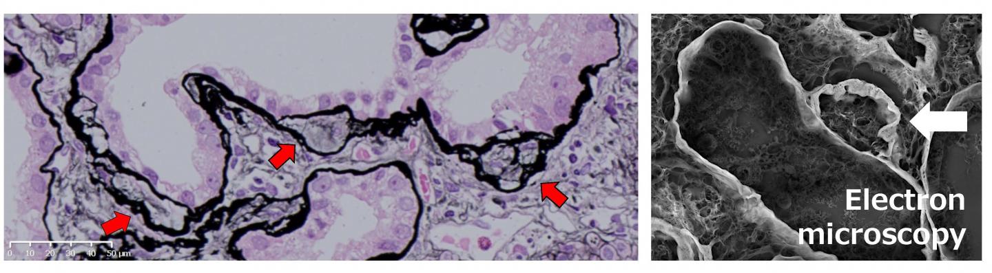 Thick duplication of tubular b [IMAGE] | EurekAlert! Science News Releases