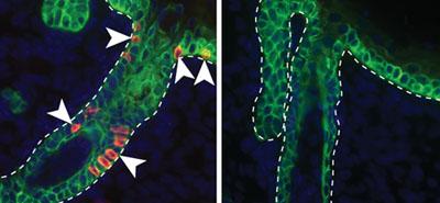 Merkel Cell Development in Mou [IMAGE] | EurekAlert! Science News Releases