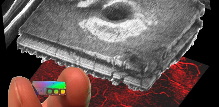 Ophthalmic OCT on a chip. [IMAGE] | EurekAlert! Science News Releases