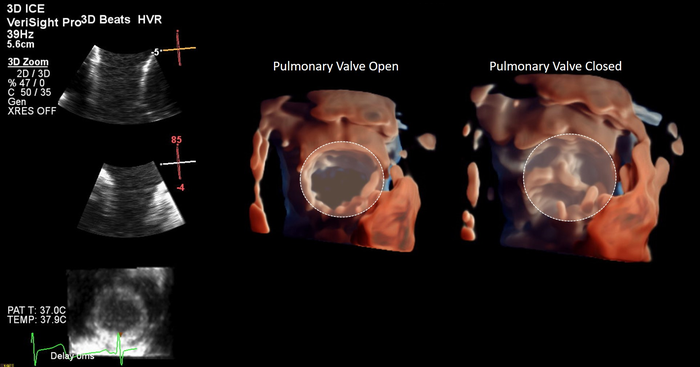 3D ICE Imaging [IMAGE] | EurekAlert! Science News Releases