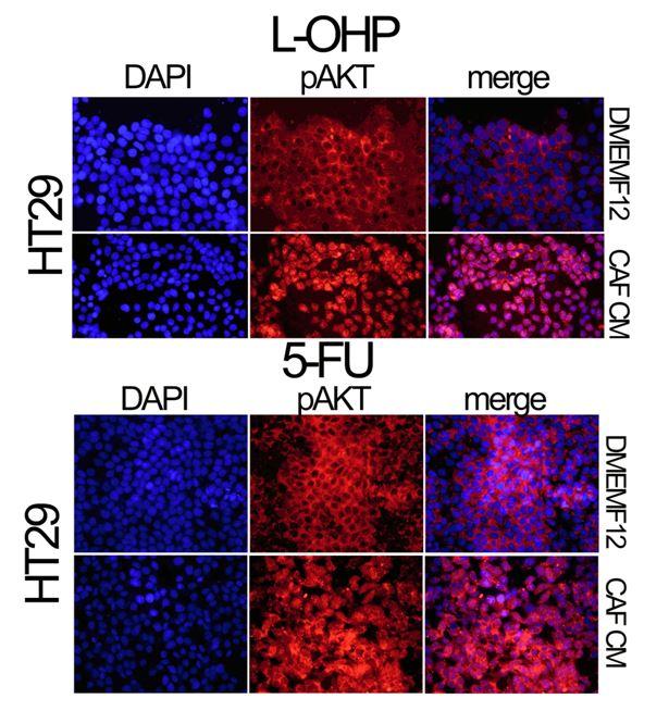 Tumor microenvironment acts as a mechanism of | EurekAlert!