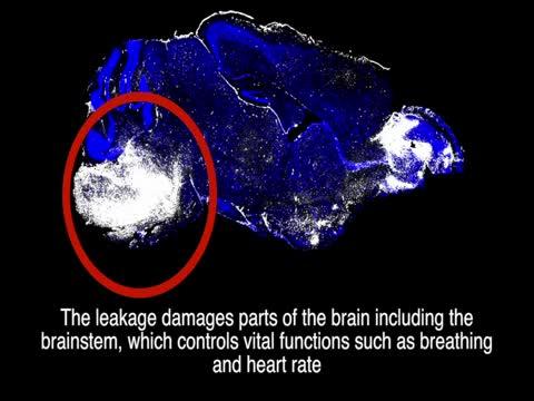 Raising the curtain on cerebral malaria's dea | EurekAlert!