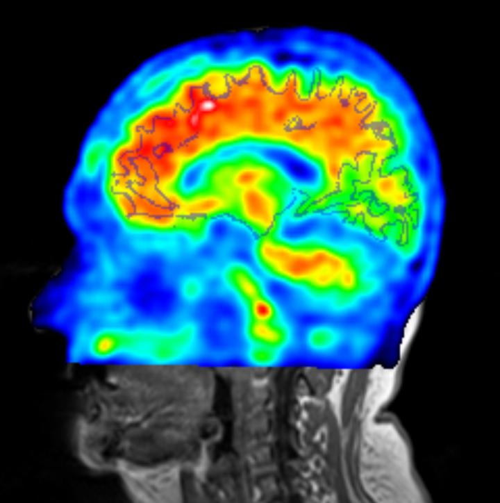 Brain Scans [IMAGE] | EurekAlert! Science News Releases