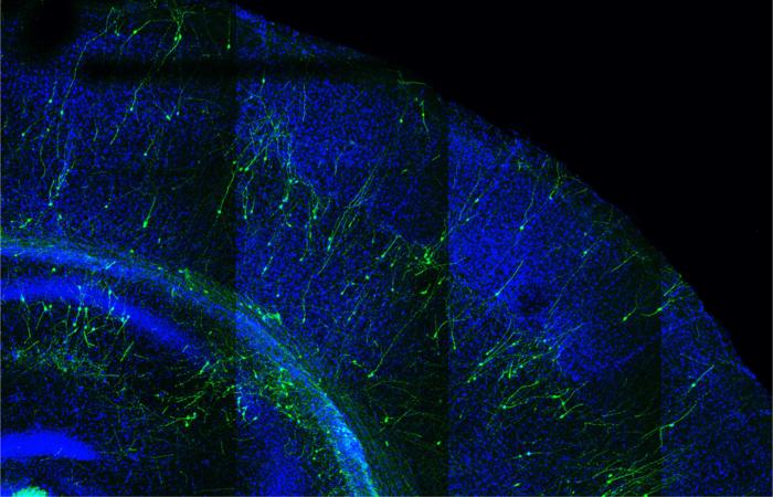 Mouse Cortex Transplanted With [image] Eurekalert Science News Releases