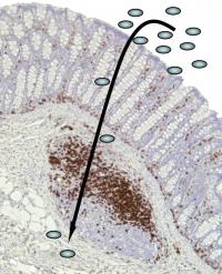 Lost Immune Cells, Invading Bacteria in HIV ( | EurekAlert!