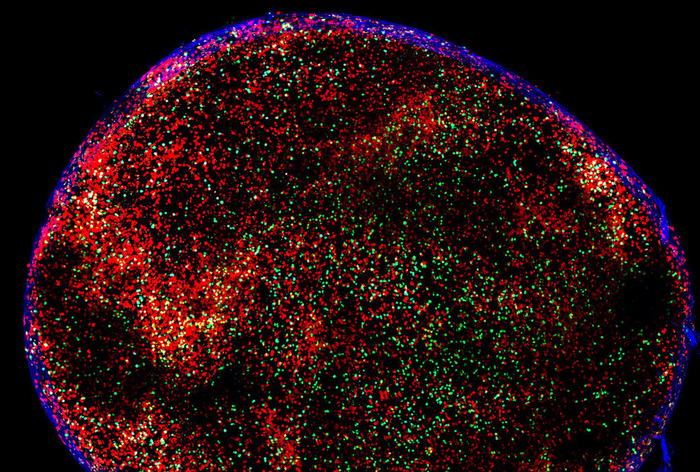 A mouse lymph node [IMAGE] | EurekAlert! Science News Releases