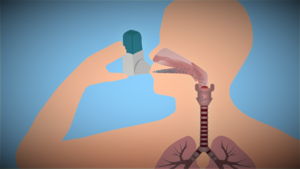 Breathe easy: New research to improve inhaler | EurekAlert!