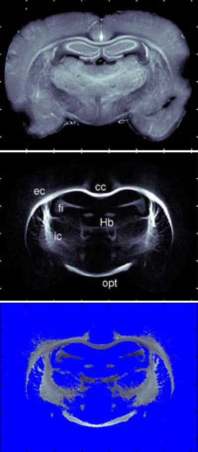 SAXS-CT Method [IMAGE] | EurekAlert! Science News Releases