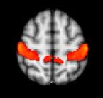 Somatosensory Cortex [IMAGE] | EurekAlert! Science News Releases