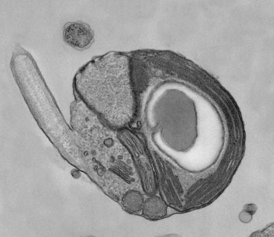 Micromonas Transmission Electr [IMAGE] | EurekAlert! Science News Releases