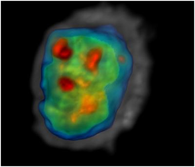 Computed Tomography Imaging of [IMAGE] | EurekAlert! Science News Releases