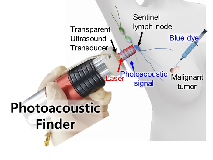 Handheld photoacoustic finder for diagnosing | EurekAlert!