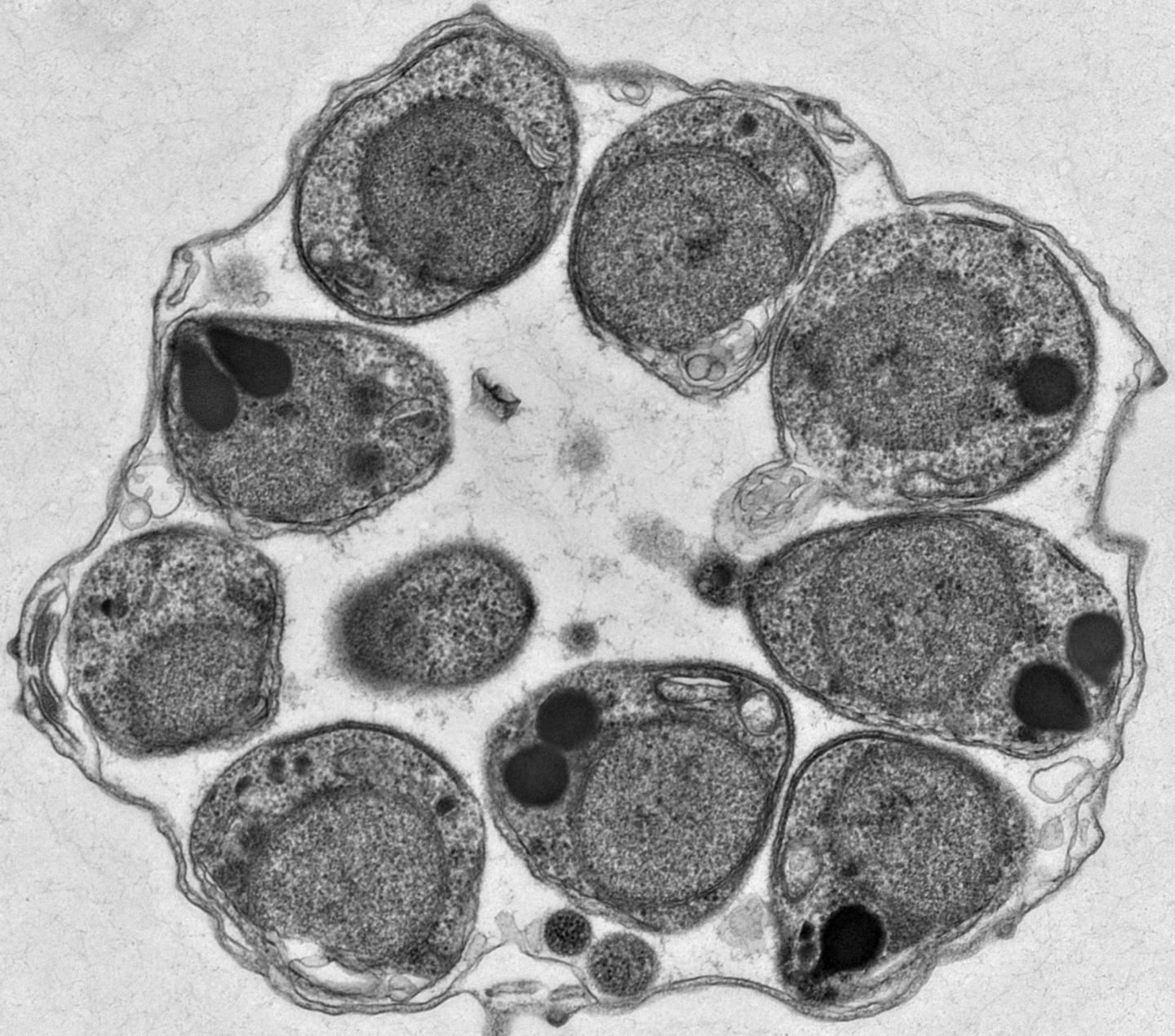Solving a Malaria Mystery Identifies New Drug | EurekAlert!