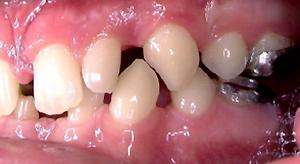 Reversing a genetic mutation to restore your | EurekAlert!