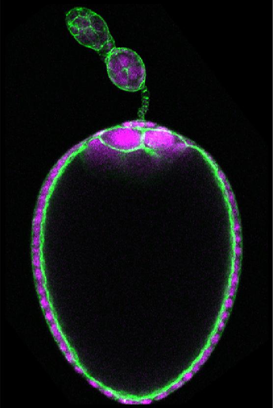 Mosquito Ovariole [IMAGE] | EurekAlert! Science News Releases