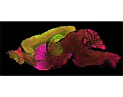 Mouse Brain [IMAGE] | EurekAlert! Science News Releases