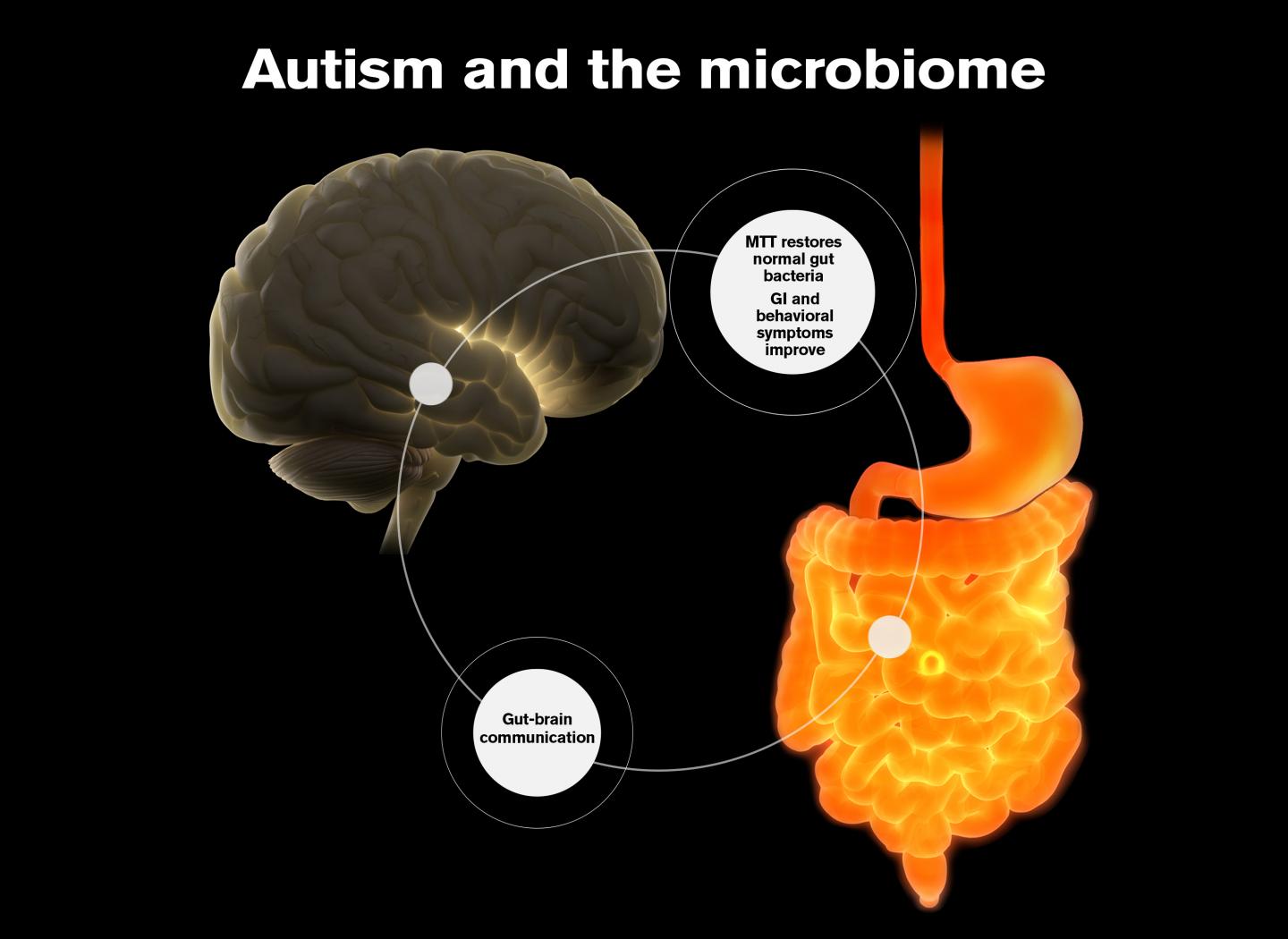 Autism symptoms reduced nearly 50% two years | EurekAlert!