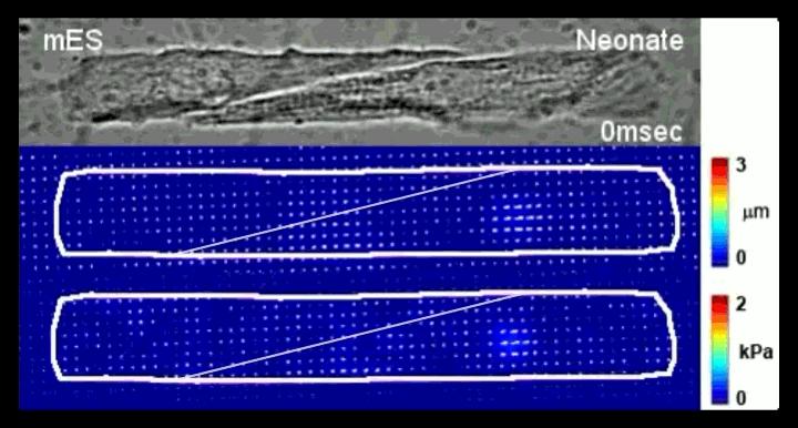 Synchronously Beating Cardiomy [IMAGE] | EurekAlert! Science News Releases