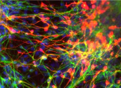 Stained Neurons [IMAGE] | EurekAlert! Science News Releases