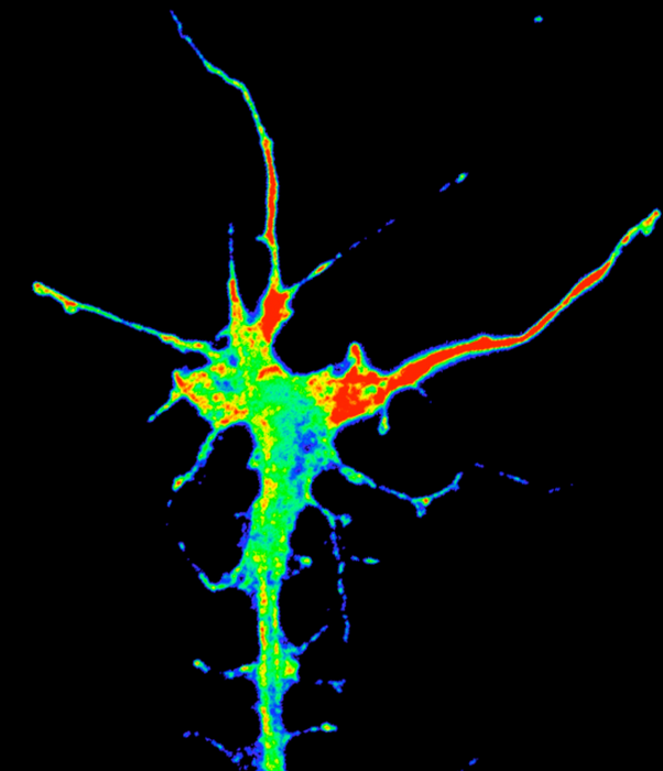 Growth cone [IMAGE] | EurekAlert! Science News Releases