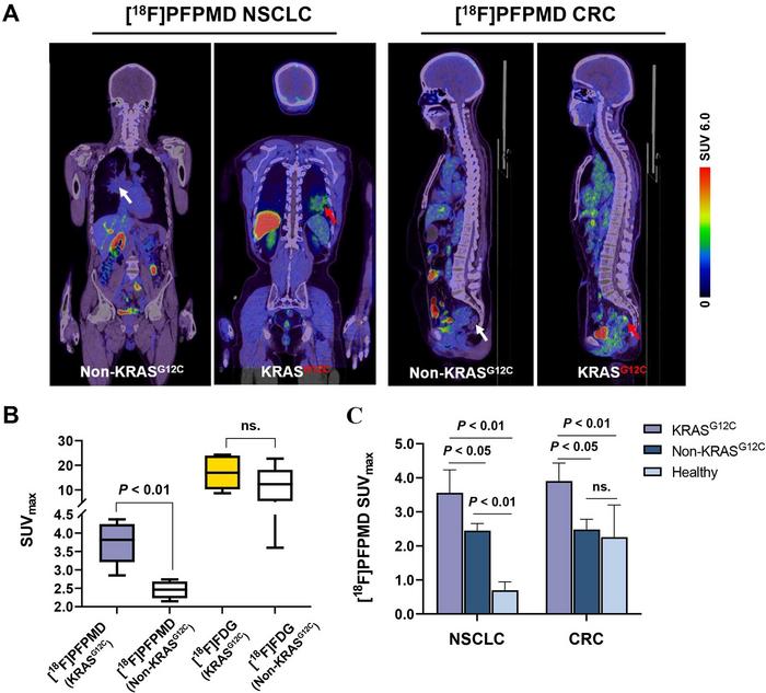New PET tracer noninvasively identifies cance | EurekAlert!