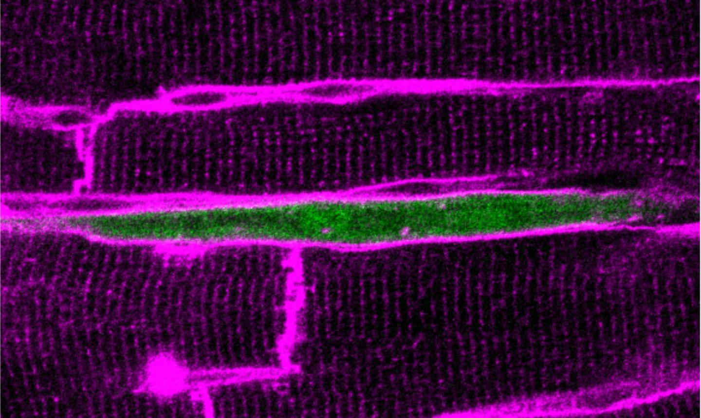 Normal vs. Mutant Cardiomyocyt [IMAGE] | EurekAlert! Science News Releases