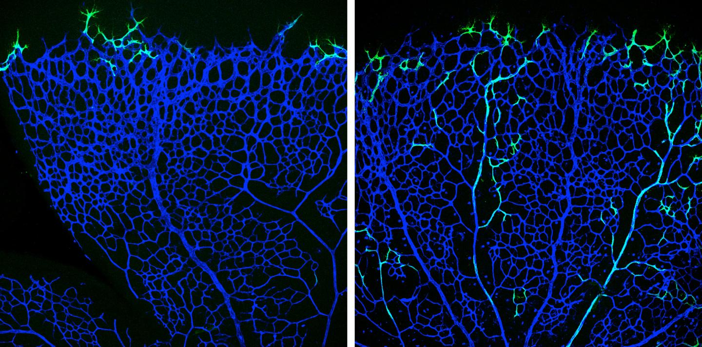 Tracking the mechanisms of artery formation | EurekAlert!