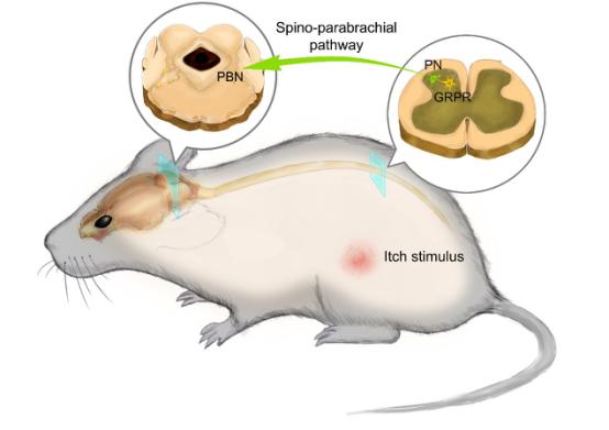Schematic Showing a Central Ne [IMAGE] | EurekAlert! Science News Releases