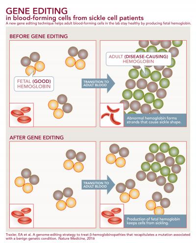 Sickle Cell Infographic [IMAGE] | EurekAlert! Science News Releases