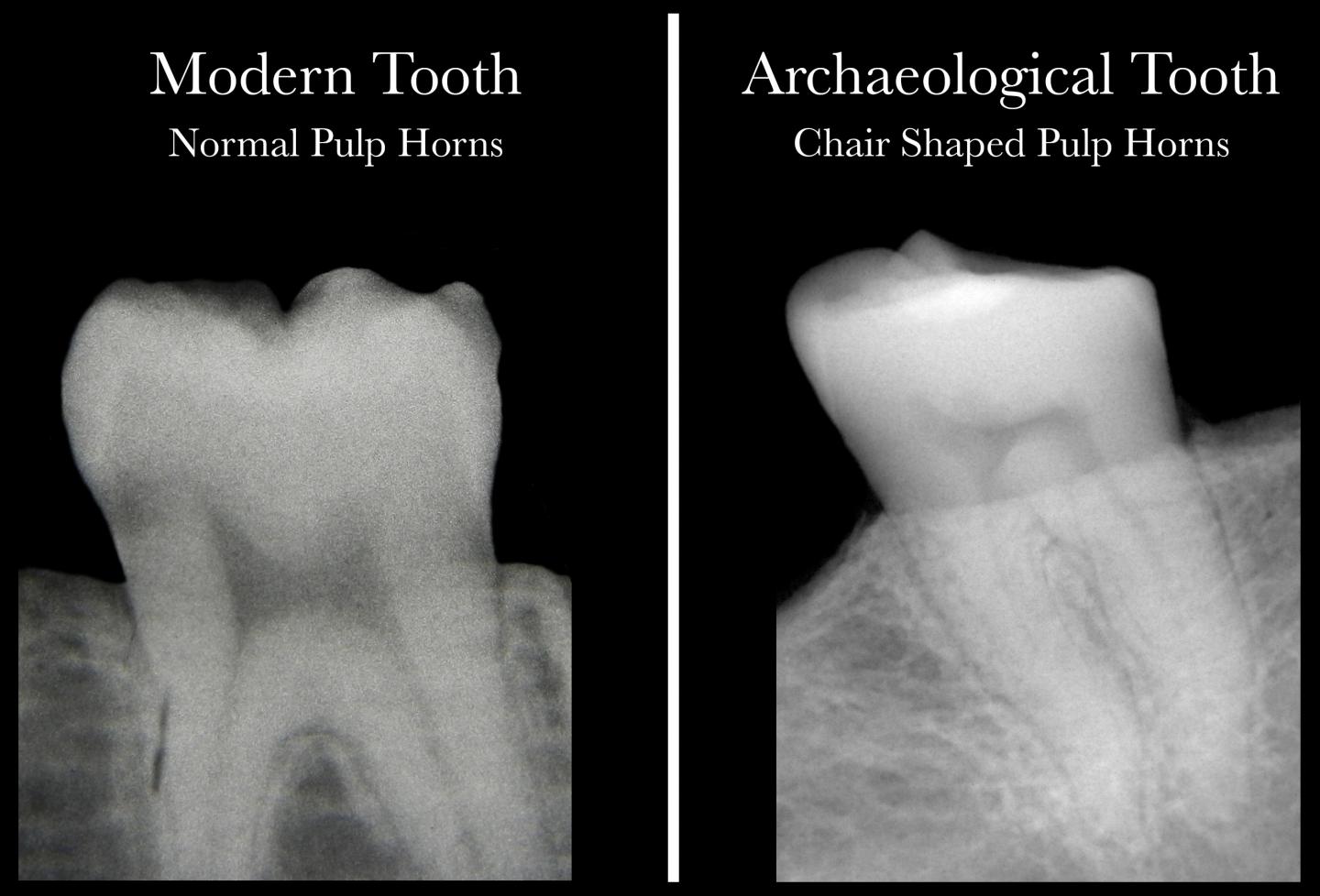 Teeth-comparison [IMAGE] | EurekAlert! Science News Releases