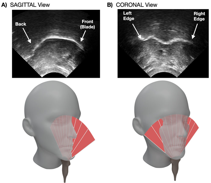Does visual feedback of our tongues help in s | EurekAlert!