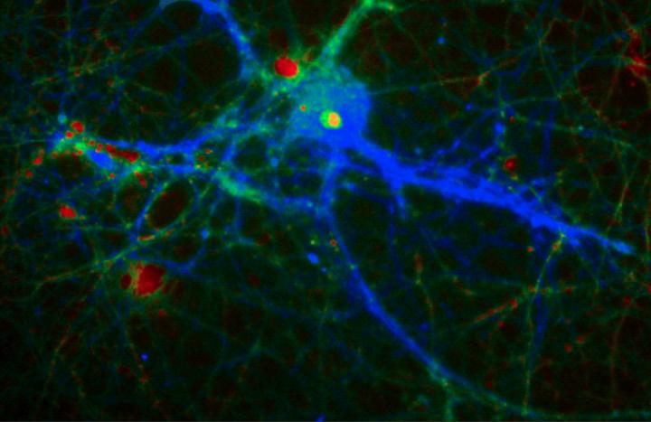 Calcium Levels within a Neuron [IMAGE] | EurekAlert! Science News Releases