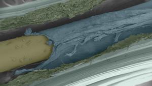 BioFiber System for Self-Heali [IMAGE] | EurekAlert! Science News Releases