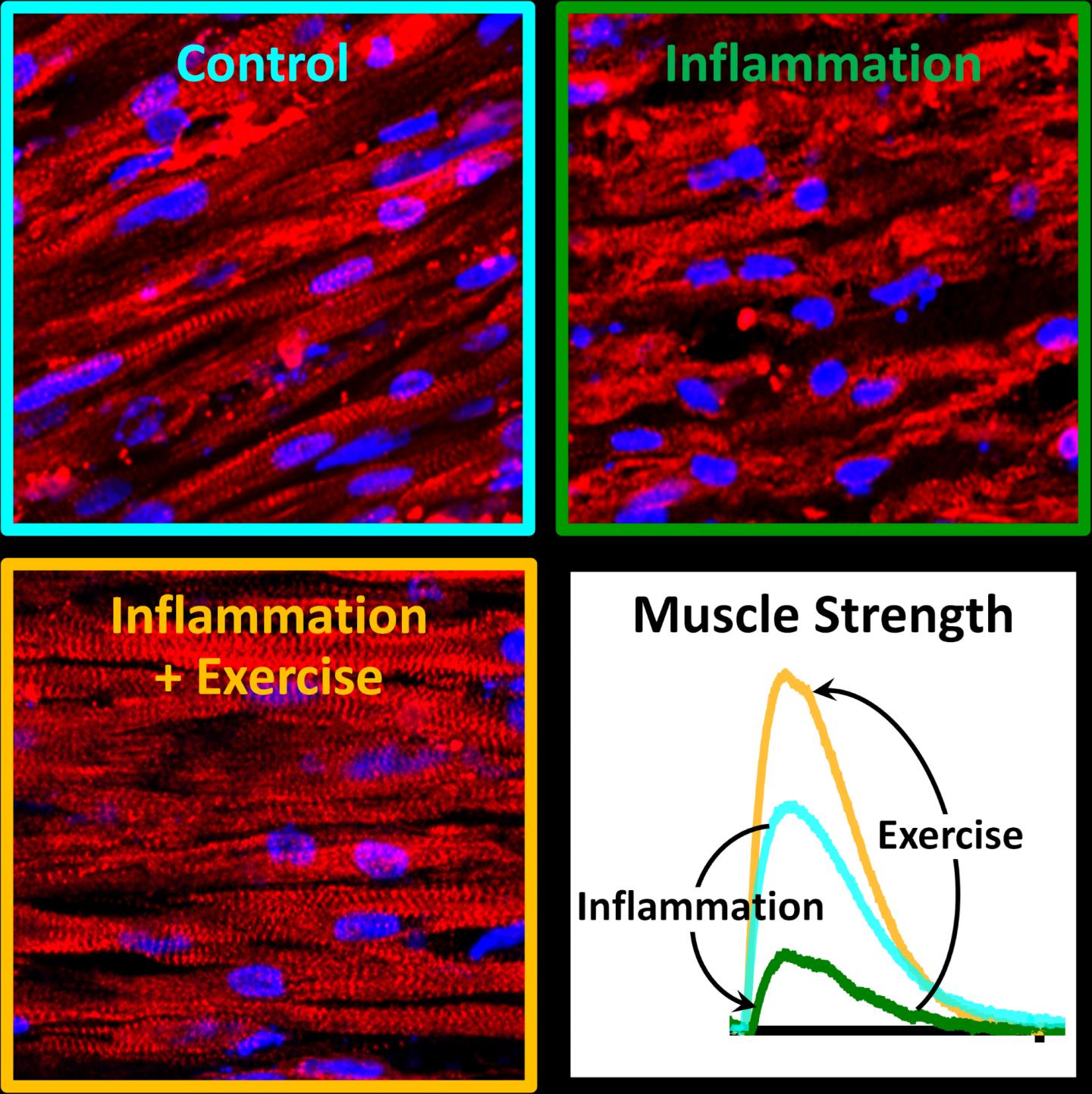 Inflammation and Exercise [IMAGE] | EurekAlert! Science News Releases