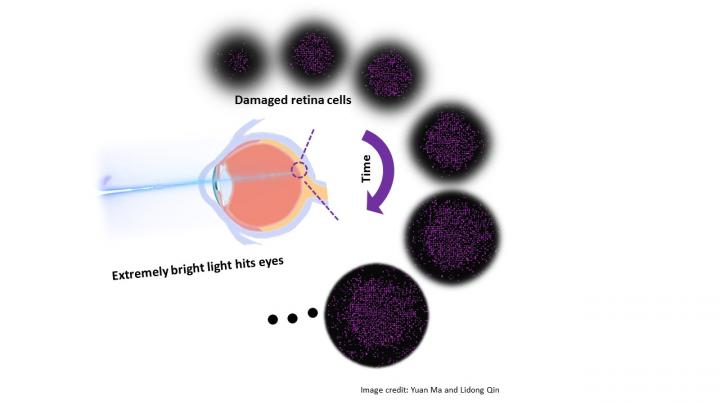Damaged Retina Cells [IMAGE] | EurekAlert! Science News Releases
