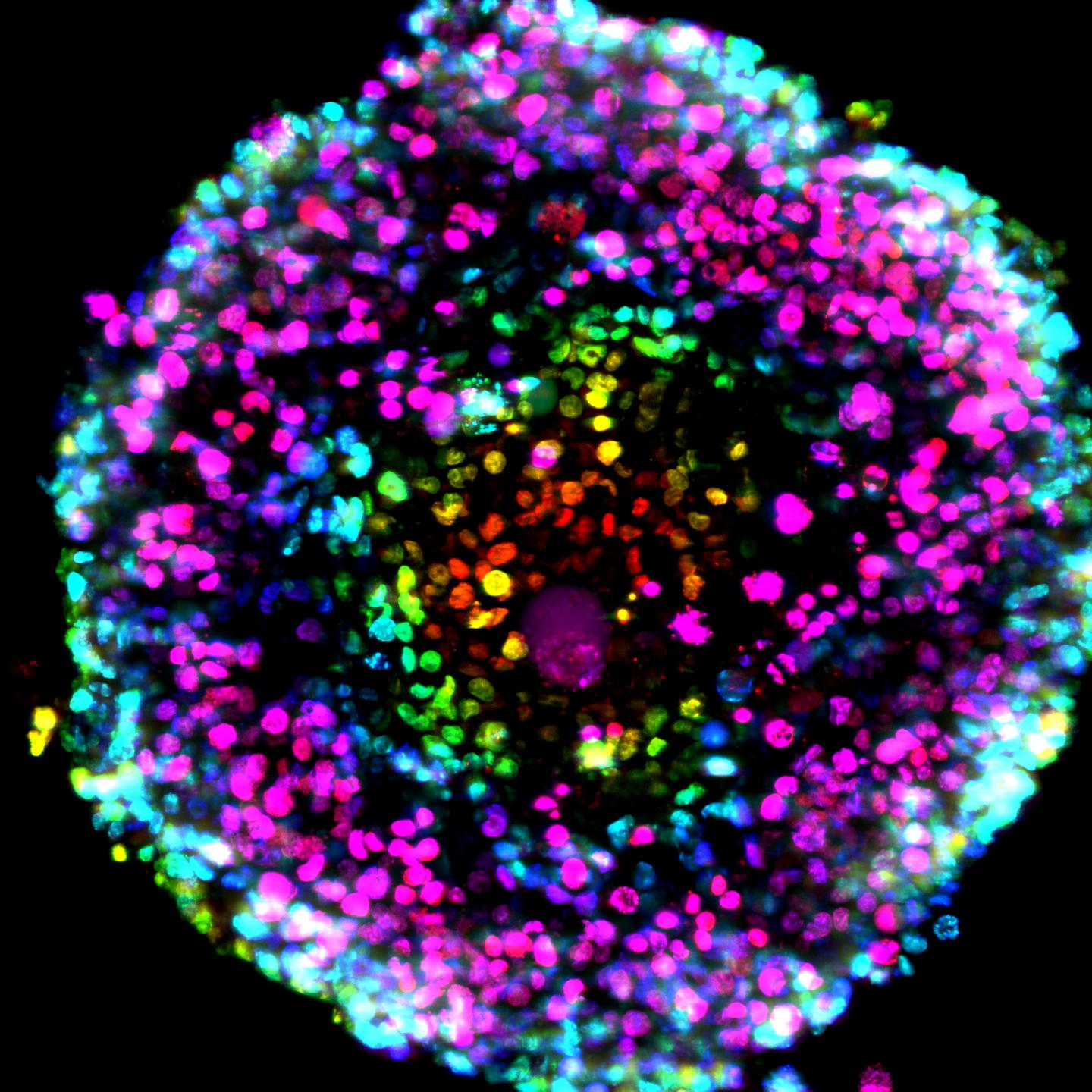 Primary pancreatic organoid tumor models for | EurekAlert!