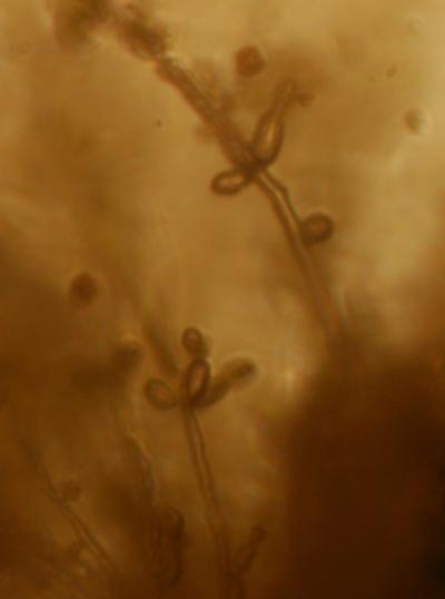 Ancient Carnivorous Fungi Lassoed its Prey (1 | EurekAlert!