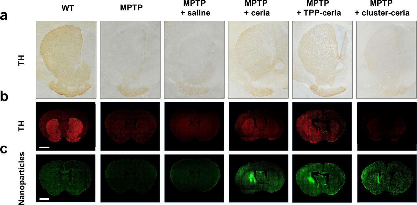 Figure 2: Mouse Brain Sections [IMAGE] | EurekAlert! Science News Releases