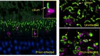 Scientists identify locations of early prion | EurekAlert!