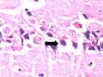 Pyknotic Nuclei [IMAGE] | EurekAlert! Science News Releases