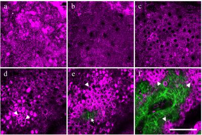 Harmonic Generation Microscopy [IMAGE] | EurekAlert! Science News Releases