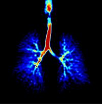 Researchers light up lungs to help diagnose d | EurekAlert!