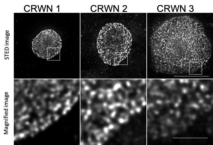 The Plant Cell Nuclear Lamina [IMAGE] | EurekAlert! Science News Releases