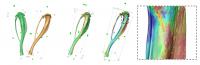 How curved are your bones? | EurekAlert!