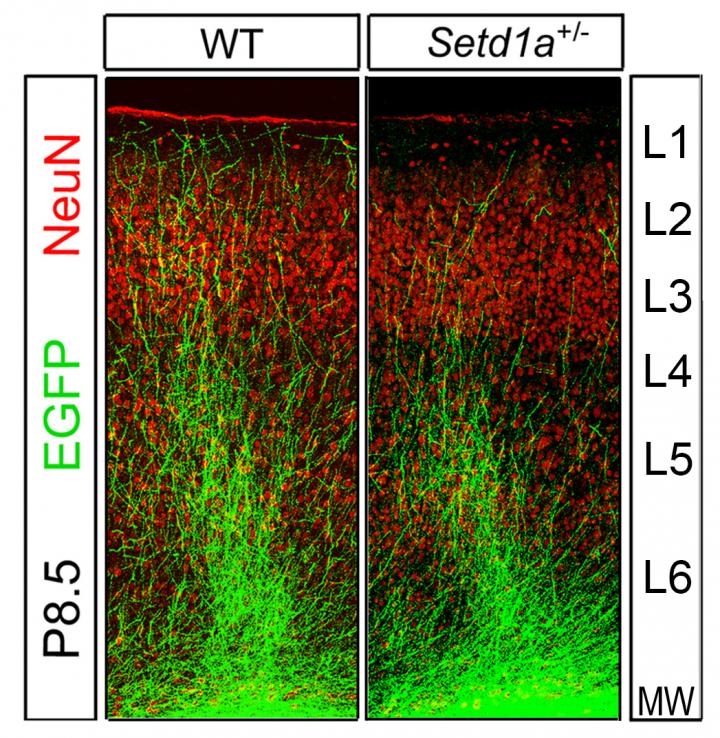 Setd1a Deficiency Disrupts Axo [IMAGE] | EurekAlert! Science News Releases