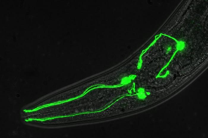 Caenorhabditis elegans [IMAGE] | EurekAlert! Science News Releases