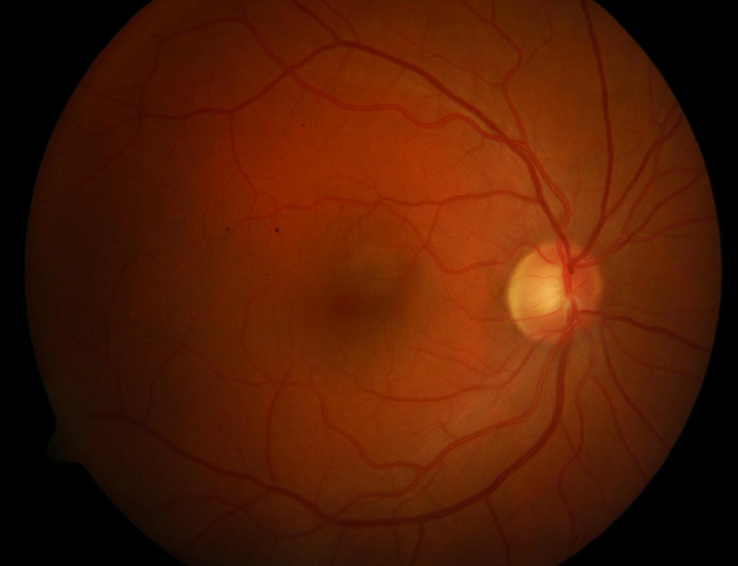Healthy Retina [IMAGE] | EurekAlert! Science News Releases