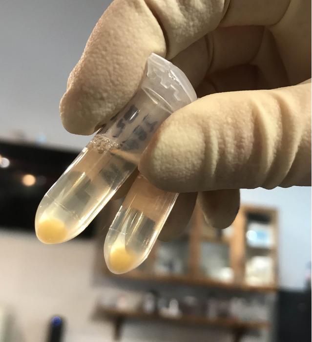 Exosome Photo [IMAGE] | EurekAlert! Science News Releases